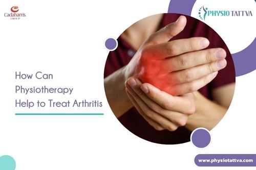 How Can Physiotherapy Help to Treat Arthritis?