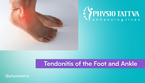 Foot & Ankle Tendonitis - Causes, Symptoms & Treatments