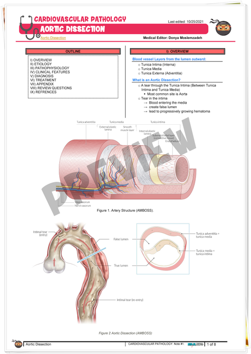 Aortic Dissection | Etiology, Pathophysiology, Diagnosis, Clinical ...