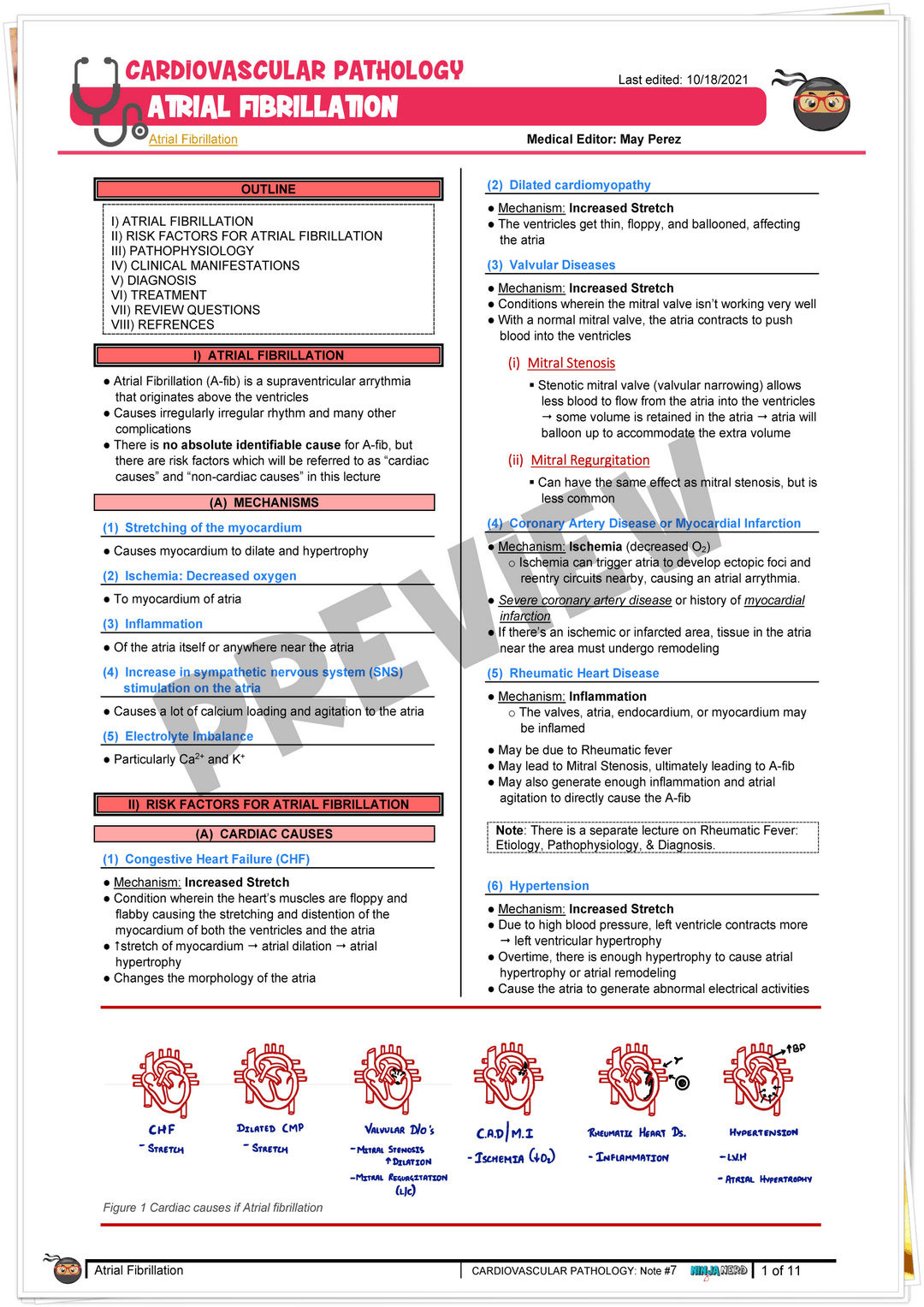 Atrial Fibrillation | Etiology, Pathophysiology, Diagnosis, Clinical ...