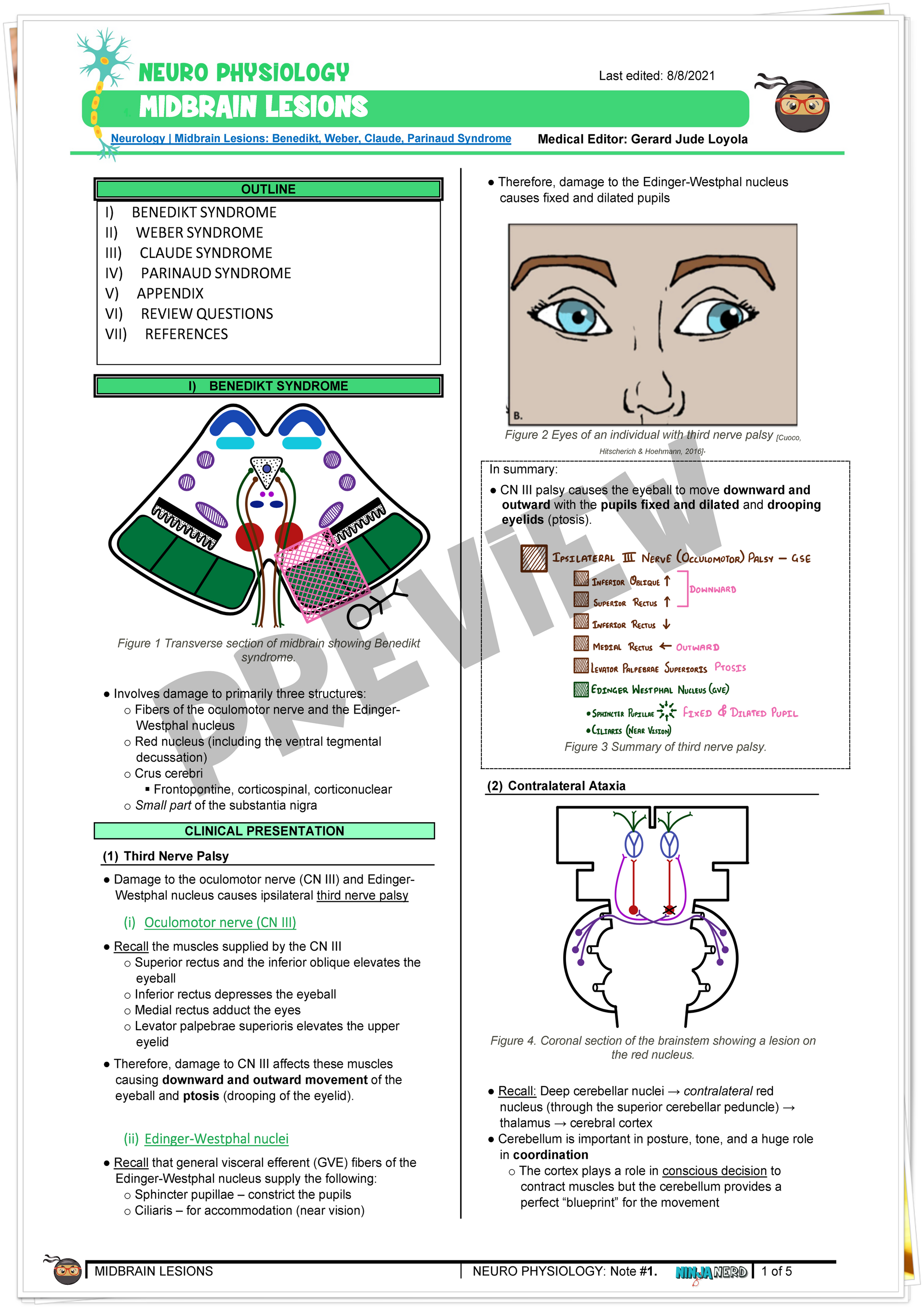 Midbrain Lesions: Benedikt, Weber, Claude, Parinaud Syndrome - Notes ...