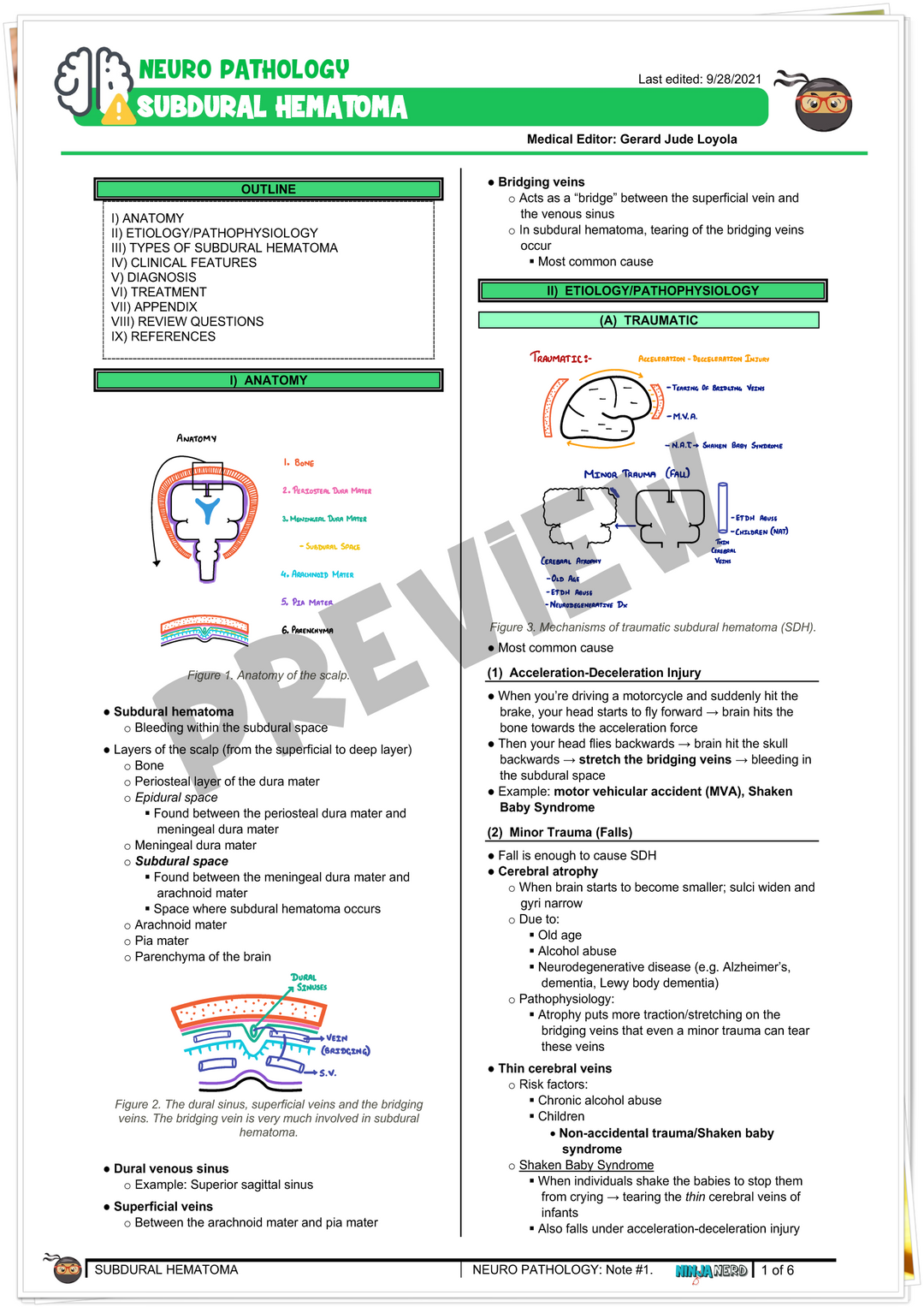 Subdural Hematoma | Anatomy, Etiology, Pathophysiology, Clinical ...