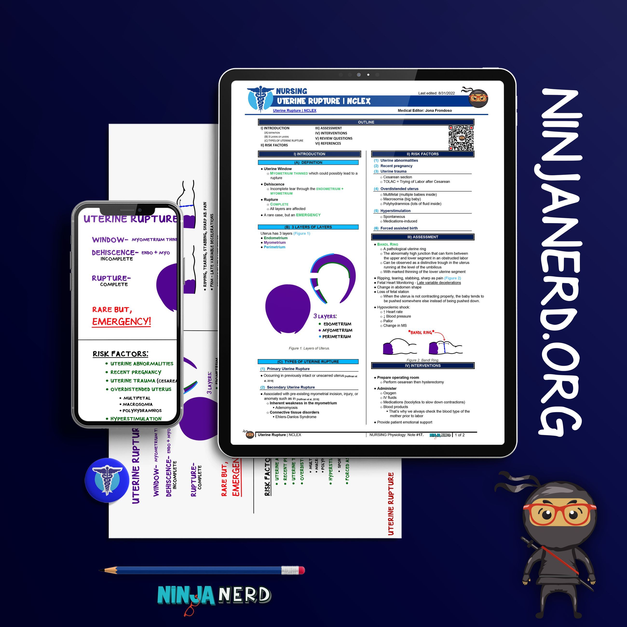 Uterine Rupture - Illustrations - NinjaNerd Medicine