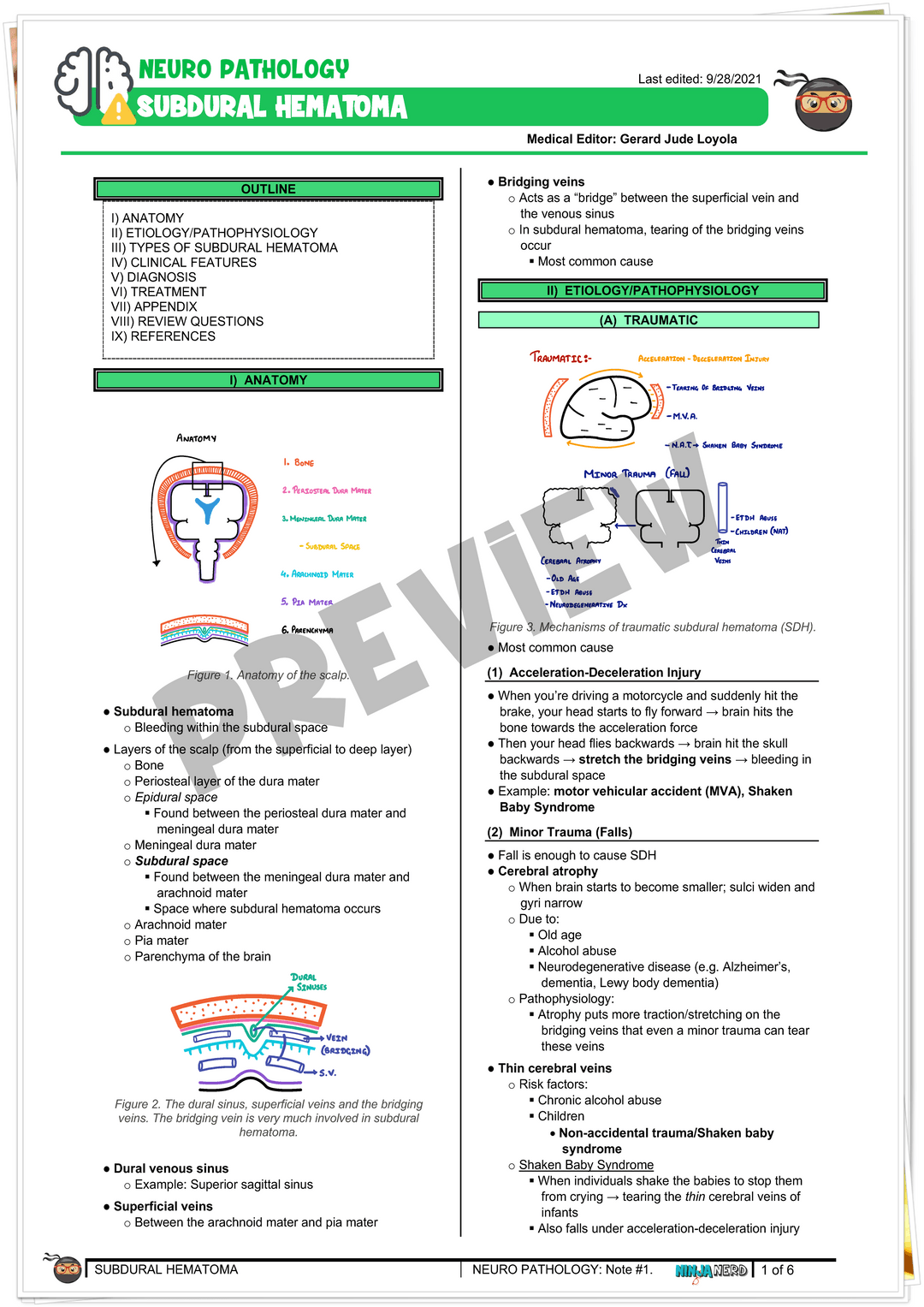 Subdural Hematoma | Anatomy, Etiology, Pathophysiology, Clinical ...