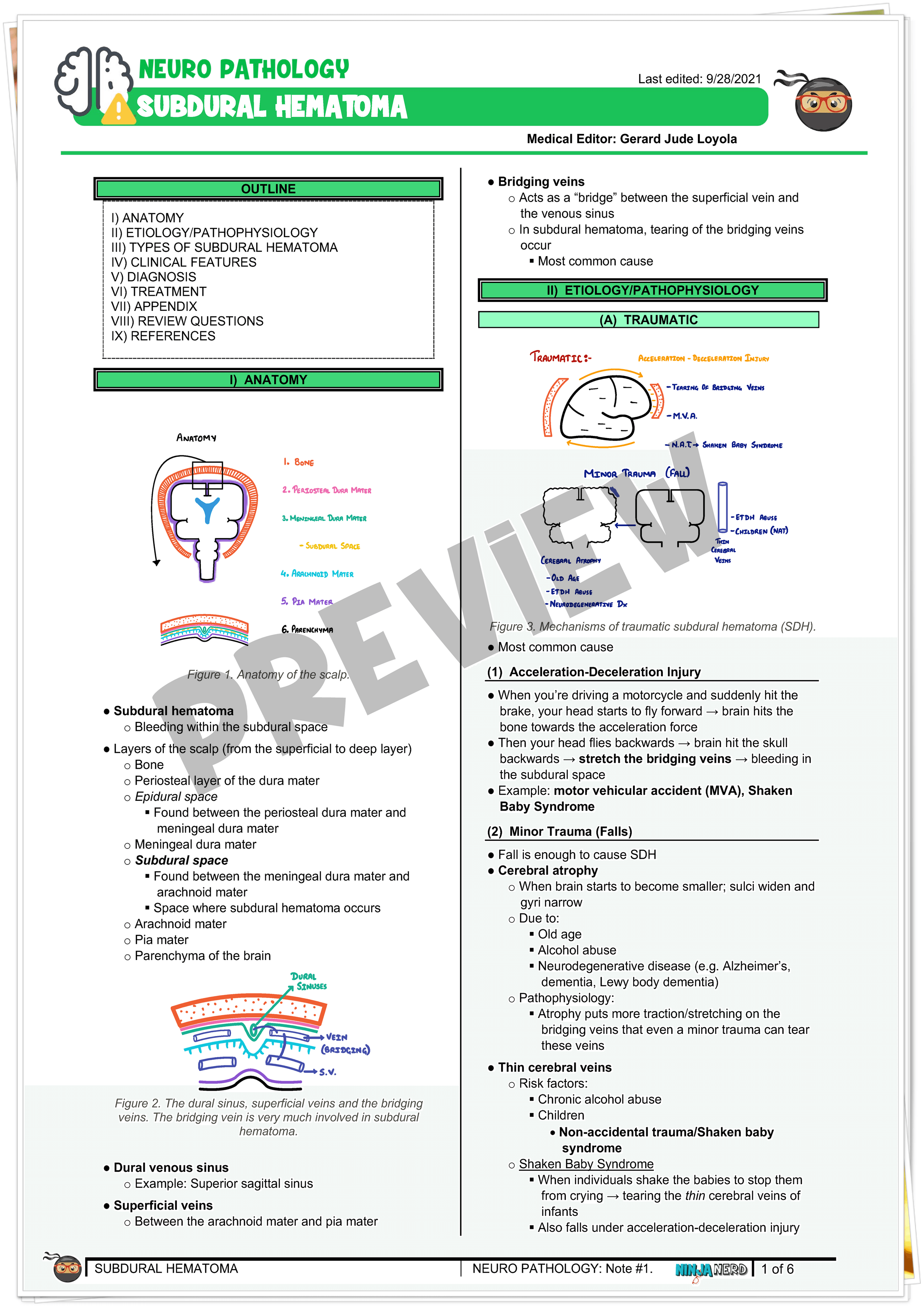Subdural Hematoma | Anatomy, Etiology, Pathophysiology, Clinical ...