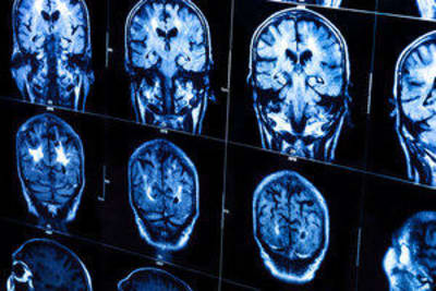 Good Brain, Bad Brain Program - University of Birmingham