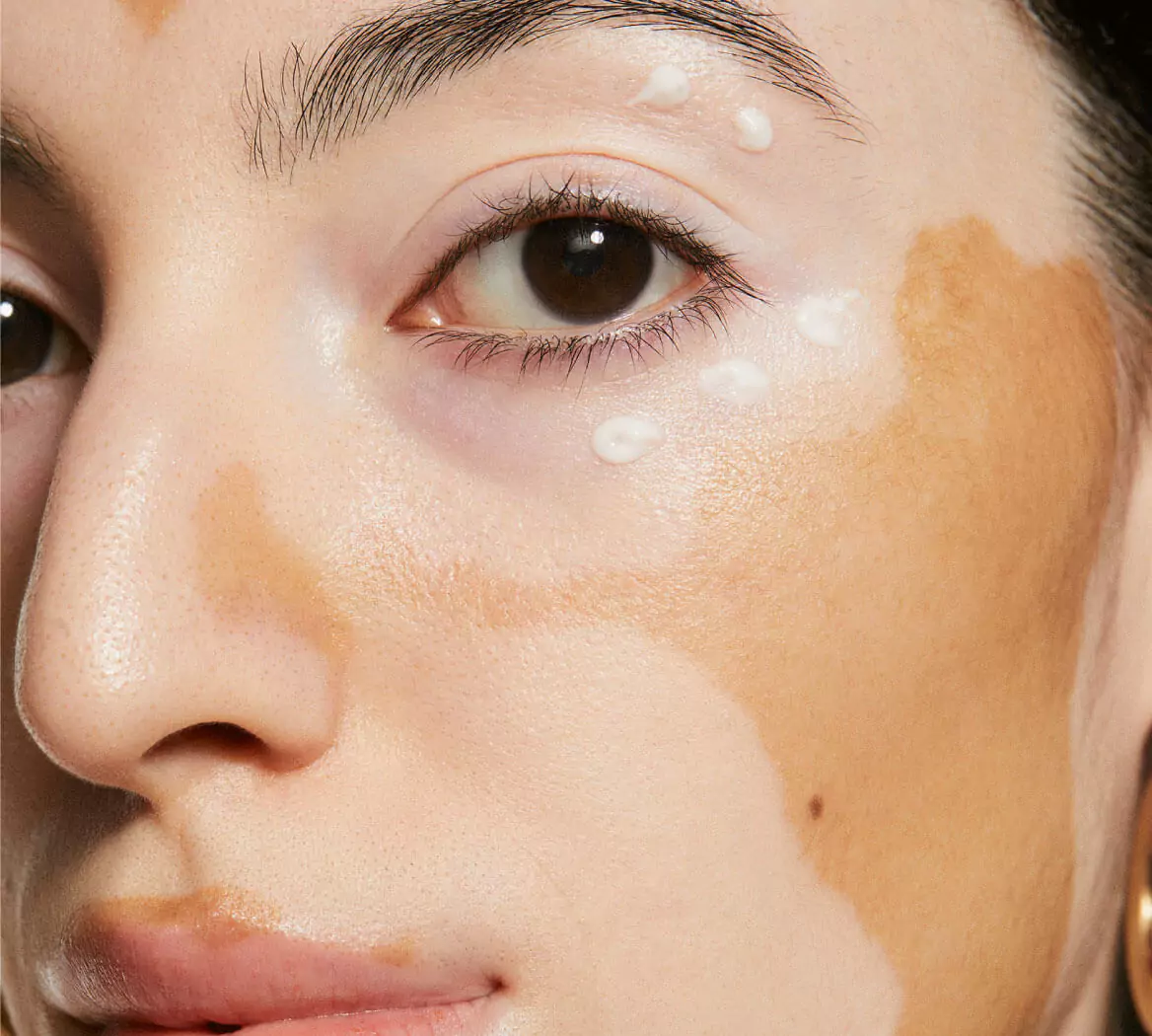 A Complete Guide For Under Eye Skin Care - Tira