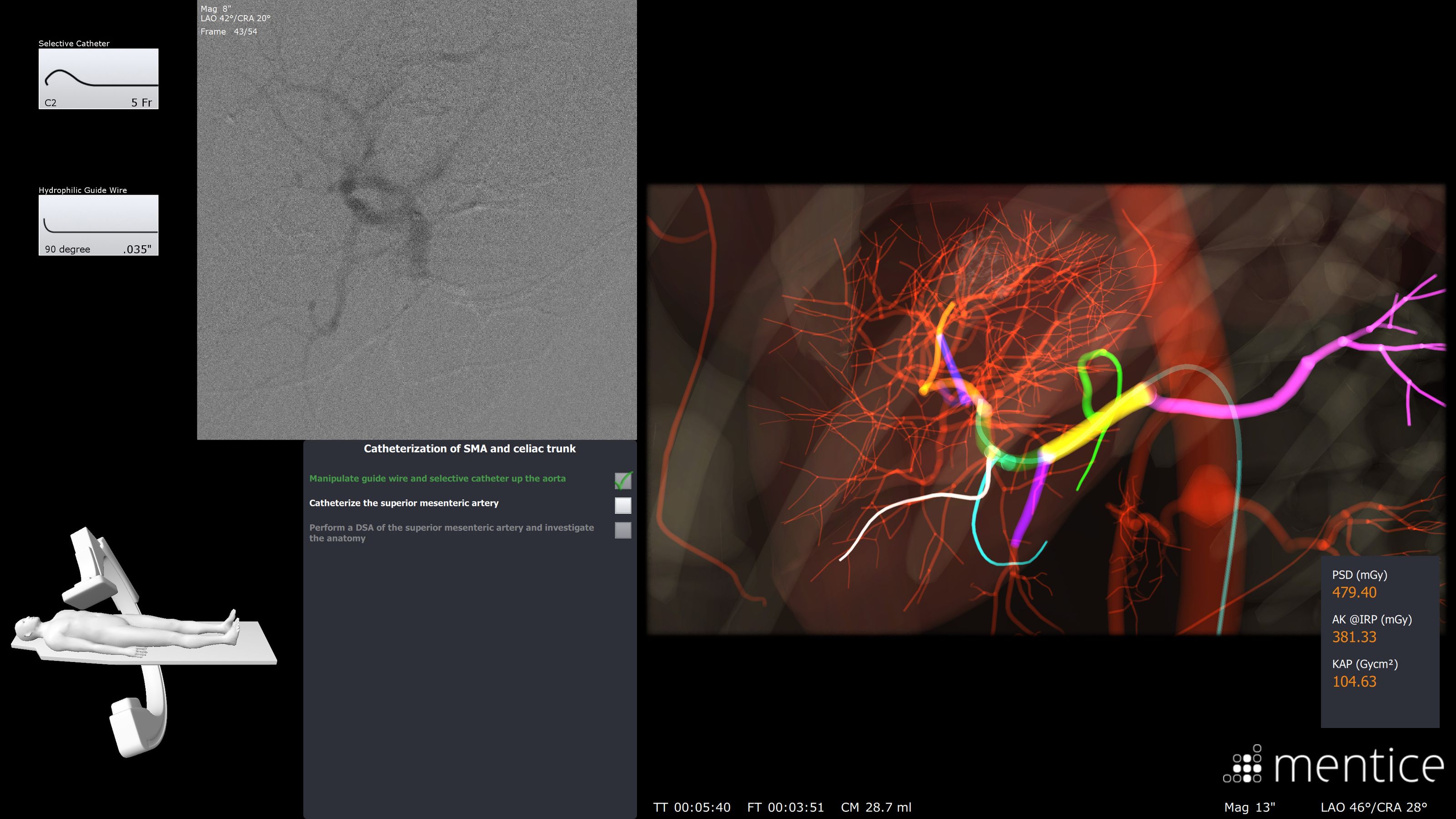 Mentice Live - Remote proctoring and learning center