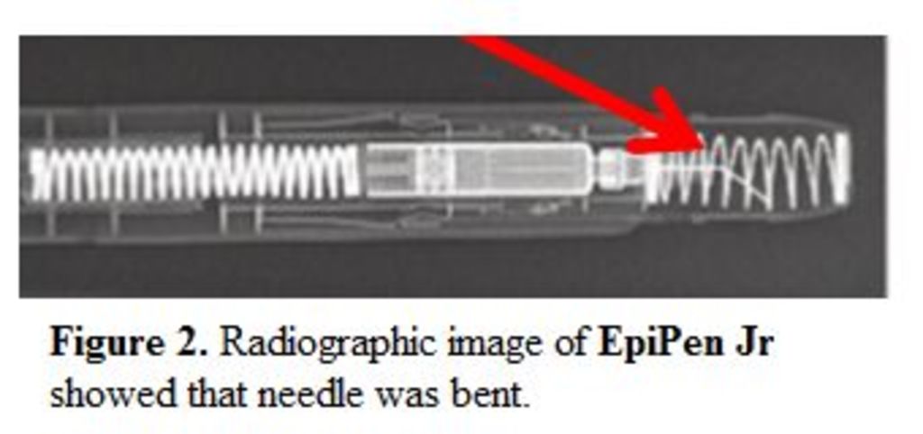Cuts on leg following EpiPen Jr use