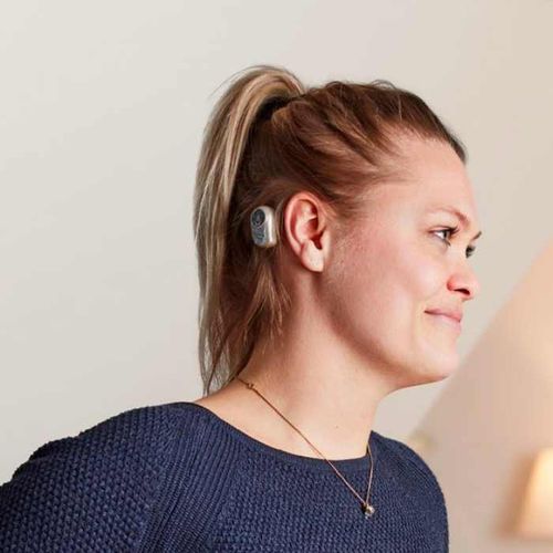 Bone Anchored Hearing Aids (BAHA) Vs Cochlear Implants and Traditional ...