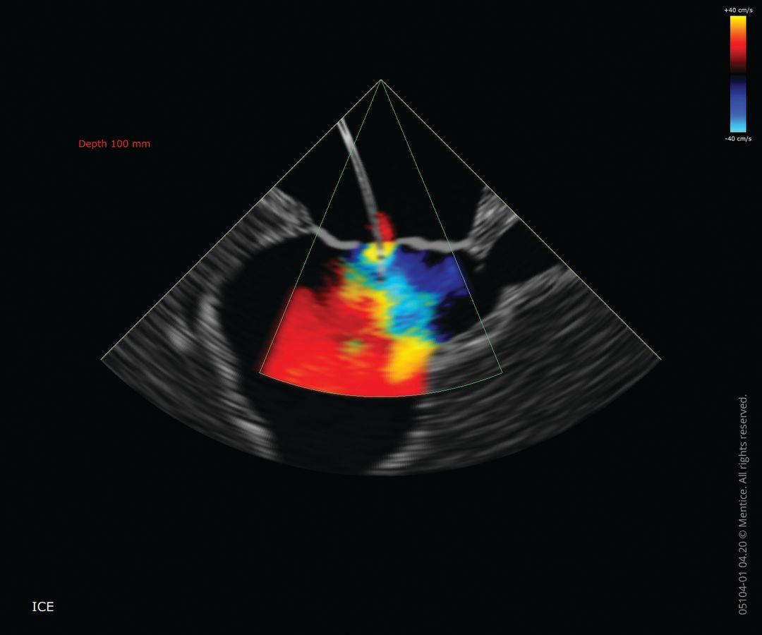 VIST® G7 and G7+ | Simulators