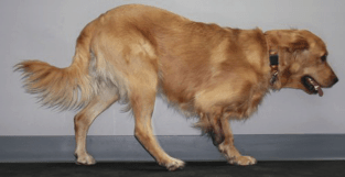 Prosthetics Basics and Subtotal Amputation