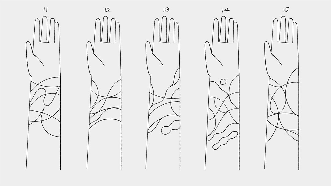 The Furrow | Symptom Checker