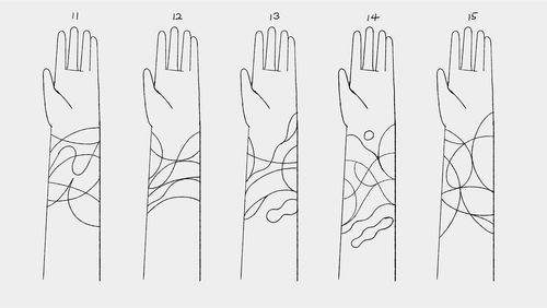 The Furrow | Symptom Checker