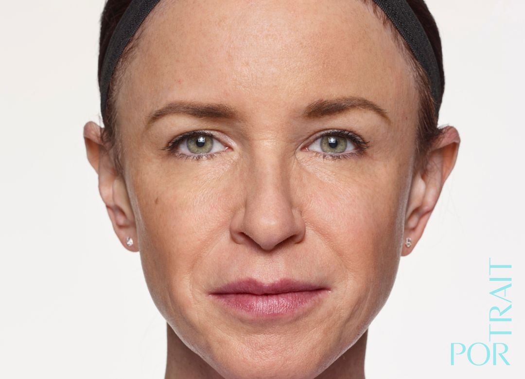 Portrait | Cosmetic Dermatology & Medical Aesthetics