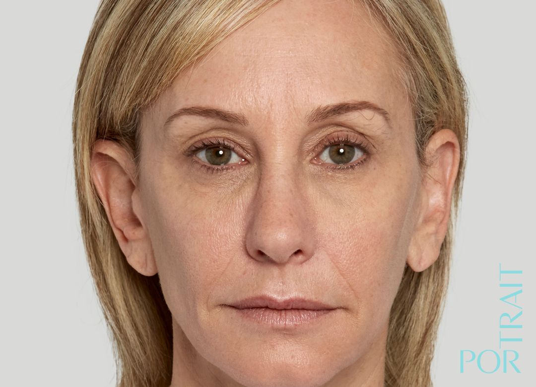 Portrait | Cosmetic Dermatology & Medical Aesthetics