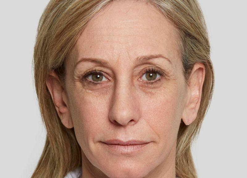Portrait | Cosmetic Dermatology & Medical Aesthetics