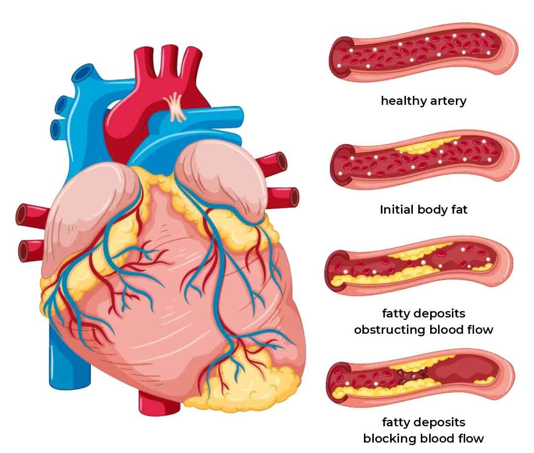 Synthesit Iron 800 Blister