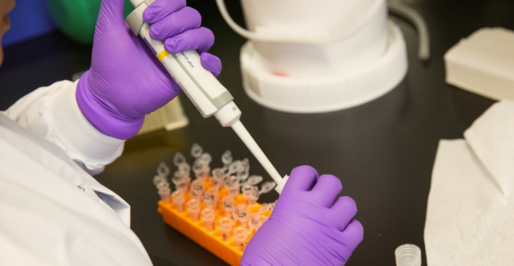 Serum-Based Colorectal Cancer Detection using OncRNAs | Exai