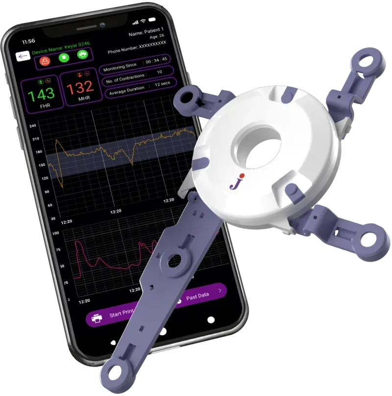 Keyar CM: Beltless Wireless Fetal Monitoring Patch
