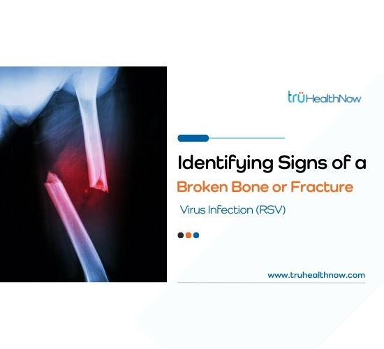 Identifying Signs of a Broken Bone or Fracture | trüHealthNow