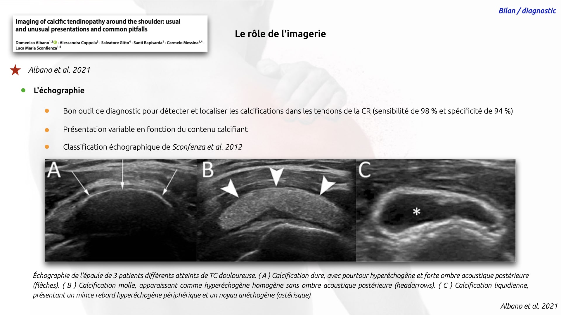 La Tendinopathie Calcifiante _ Calcification de l’epaule : symptômes ...