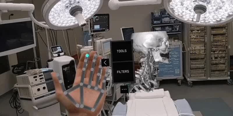 SurgicalAR | Medivis