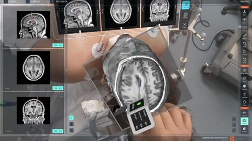 The last surgical imaging platform you'll ever need.