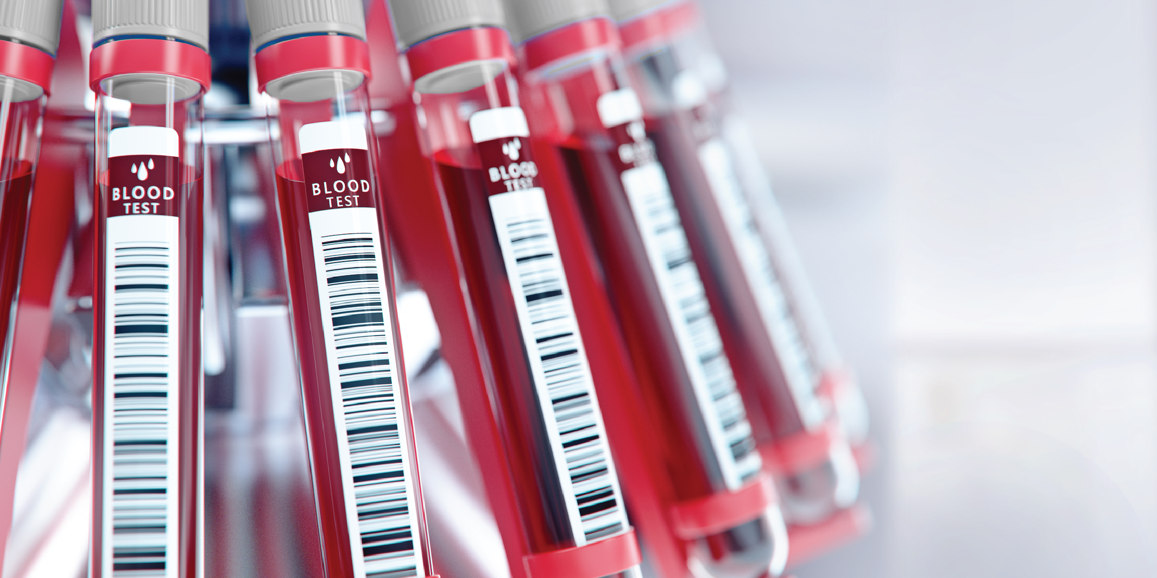 What Does Routine Blood Work Check For? | Next Health