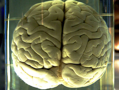 Study Shows How Intelligence In Humans First Evolved